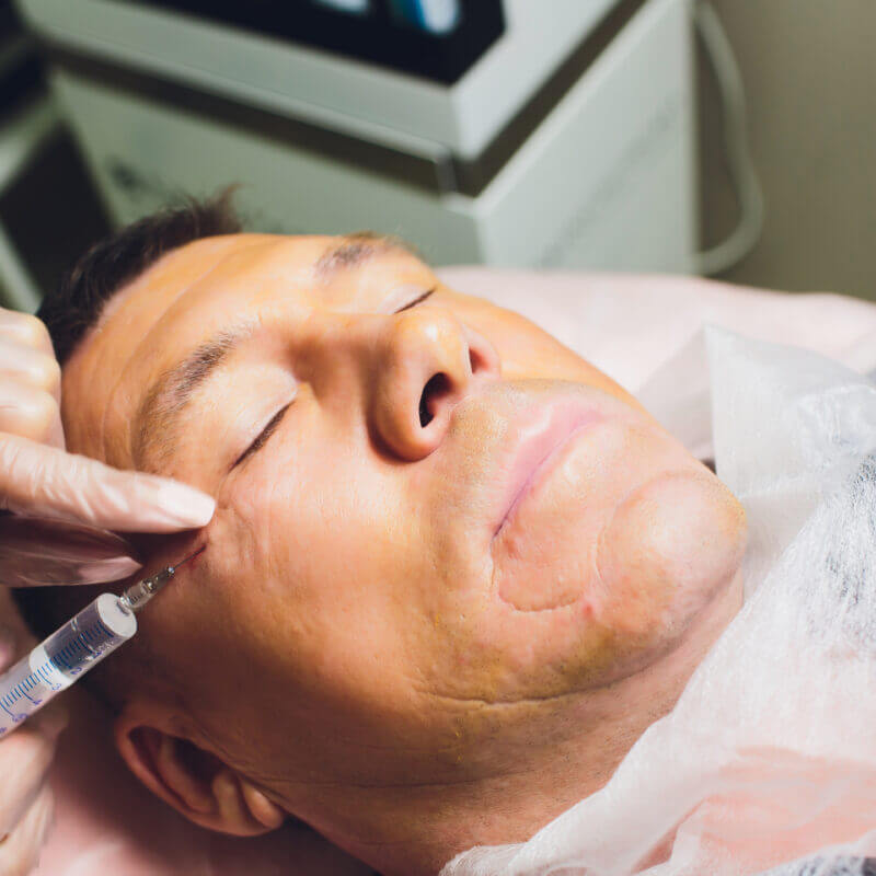 Men Injectables Treatments in Haslett, MI | Skin Boss Med Spa