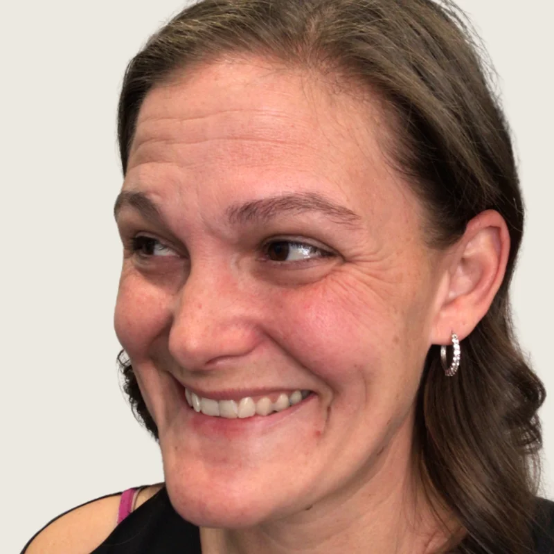 Before And Amazing | Skin Boss Med Spa In Haslett, MI