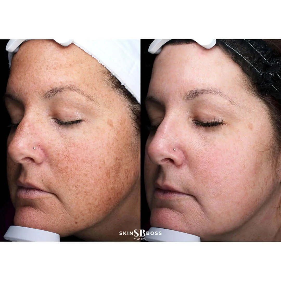 Testimonials - Skin Boss Med Spa