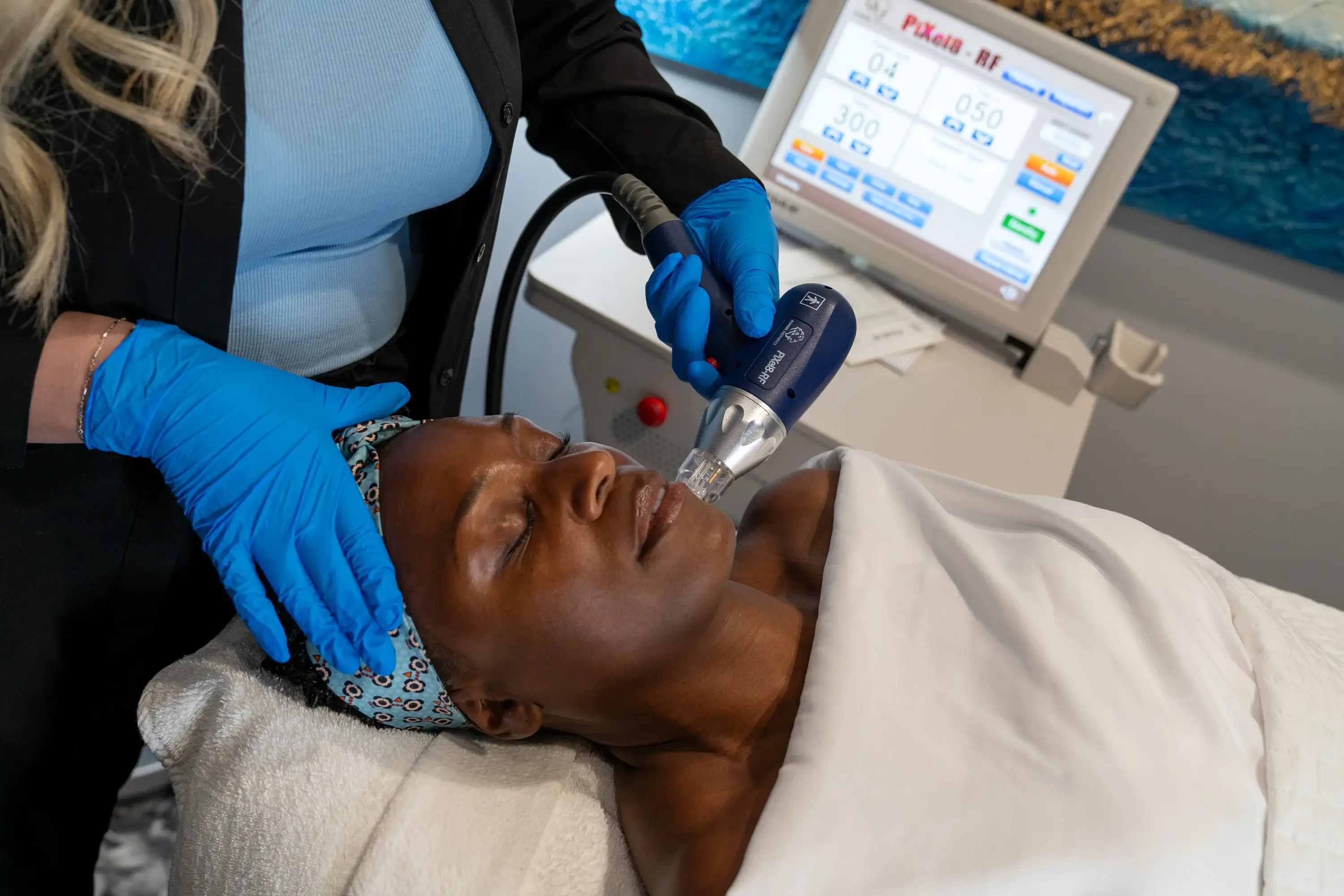 Pixel8-RF Microneedling Lansing MI - Skin Boss Med Spa