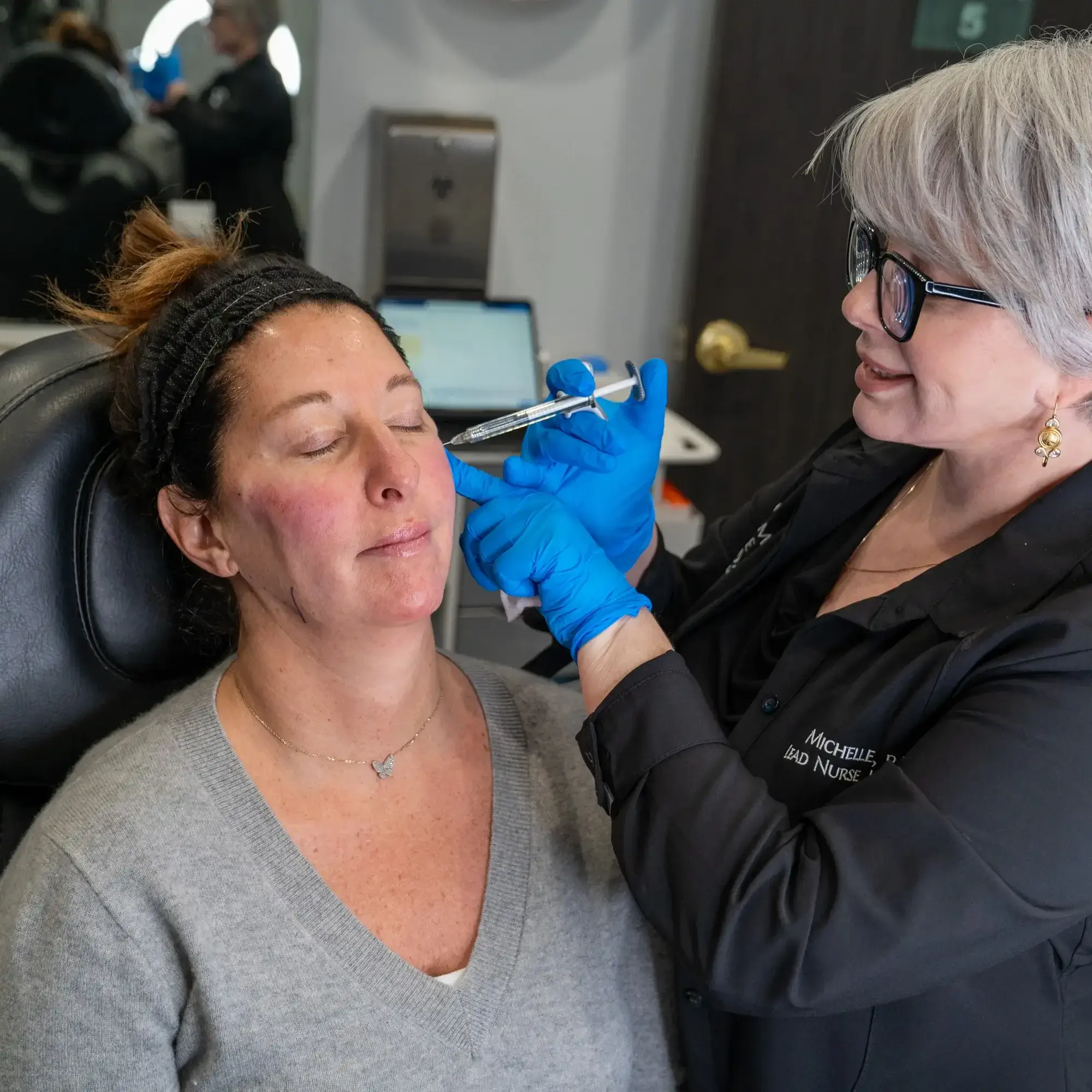 Thinning Lips - Skin Boss Med Spa